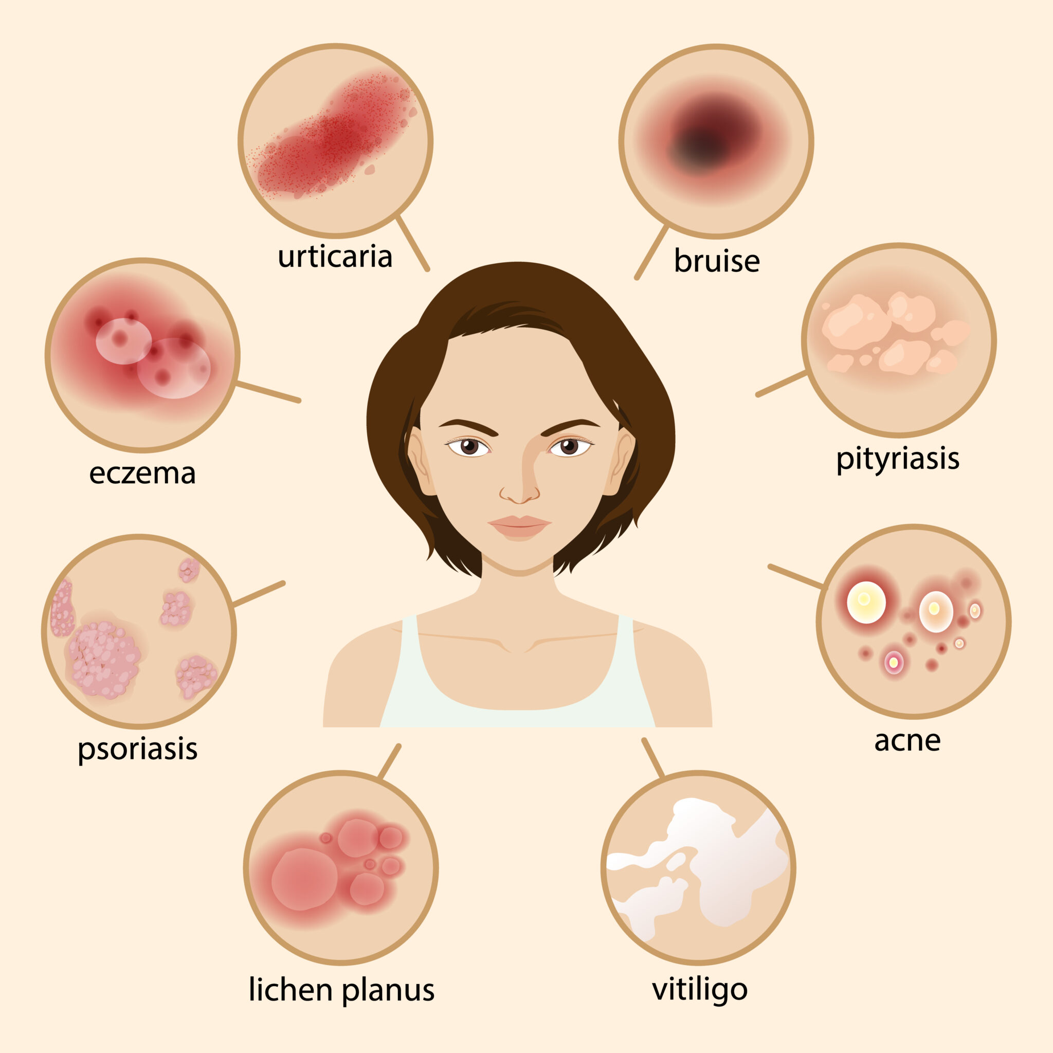 Skin Conditions And Diseases: A Complete Assessment Guide